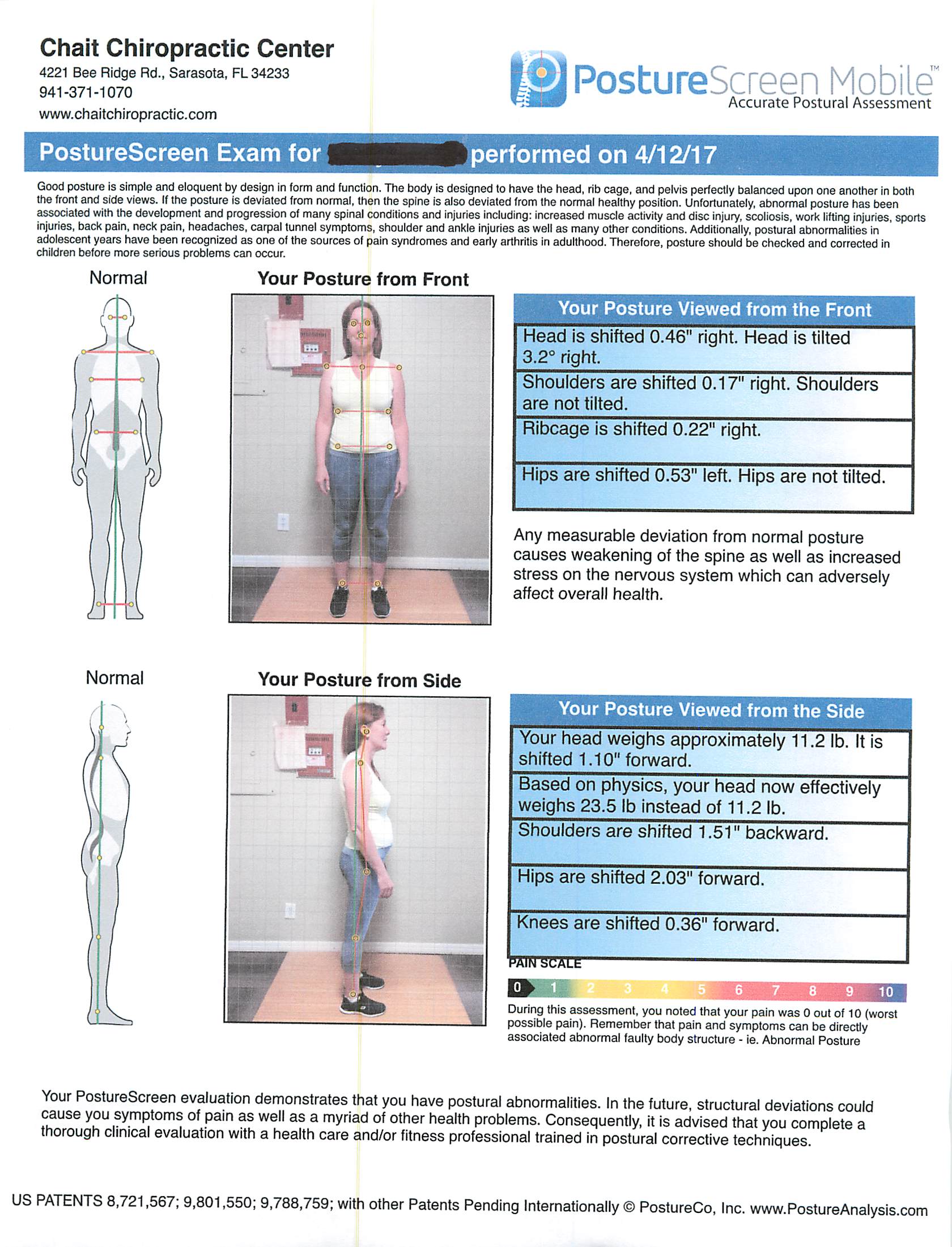 What Does Your Posture Look Like? – Chait Chiropractic